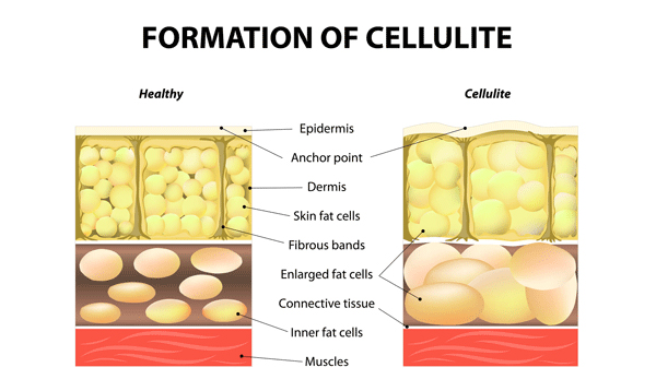 Extreme Slimming Cellulite Cream Extreme Slimming Cellulite Cream