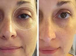 Tighten' Up Crepey Skin Cream